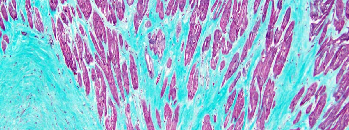 Des illustrations artistiques d’histologie autopsique nous font voir la mort sous un nouveau ...