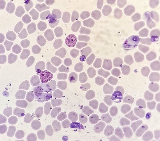 Facilitating Malaria Research with a Battery-Powered Microscope ...