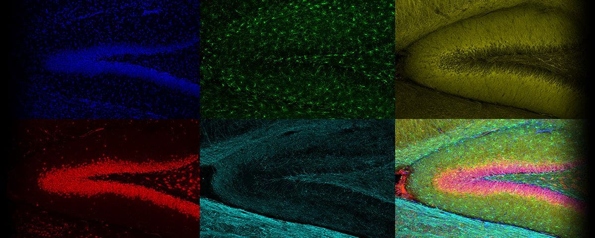 NIR Solutions for Multiplexed Confocal Imaging | オリンパス ライフサイエンス