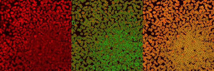 Olympus scanR High-Content Screening Station v. 3.3, 빠르고 효율적인 이미지 분석을 ...