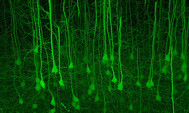 Evident Scientific | Life Science and Industrial Microscope Solutions