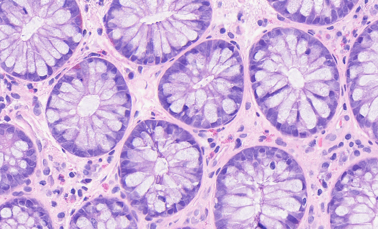 Evident Scientific | Life Science and Industrial Microscope Solutions