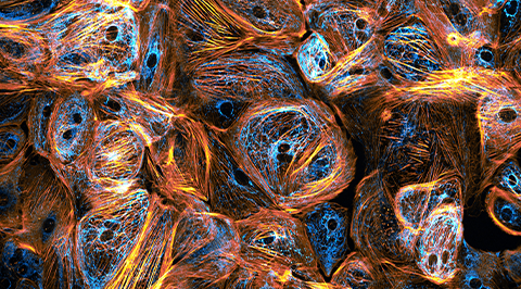 Evident Scientific | Life Science and Industrial Microscope Solutions