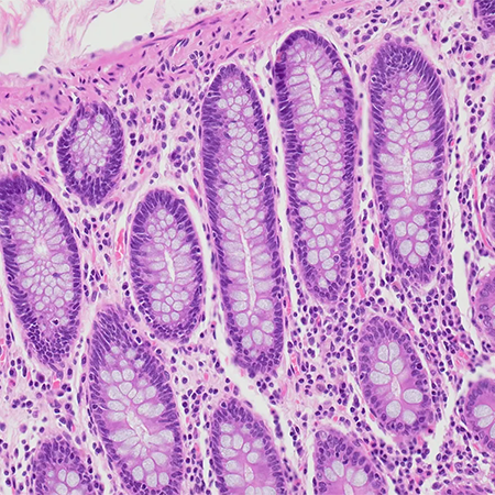 Evident Scientific | Life Science and Industrial Microscope Solutions
