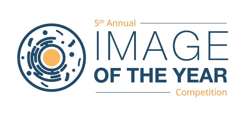 Fifth EVIDENT Image of the Year Award | 奥林巴斯生物显微镜