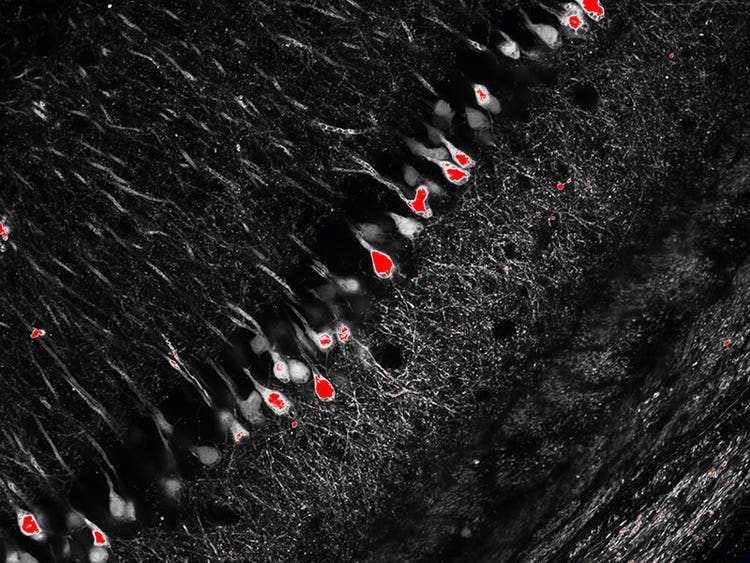 介绍FV4000激光共焦显微镜 | Evident LS