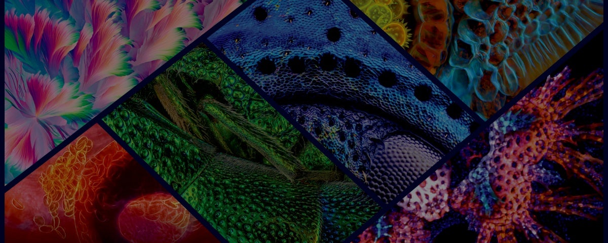 Fifth EVIDENT Image of the Year Award | 奥林巴斯生物显微镜